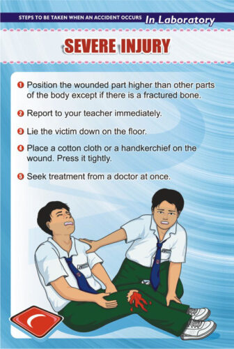 Steps To Be Taken When An Accident Occurs In Laboratory - Progressive ...