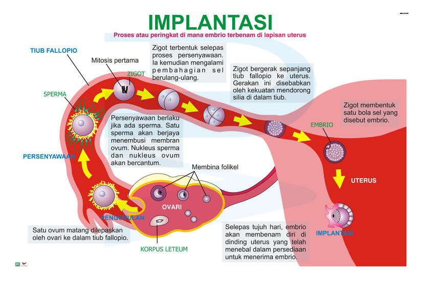 Implantasi - Progressive Scientific Sdn. Bhd.