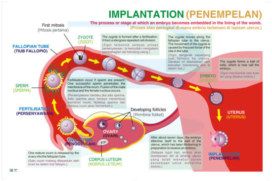 Implantation – BI, BM - Progressive Scientific Sdn. Bhd.